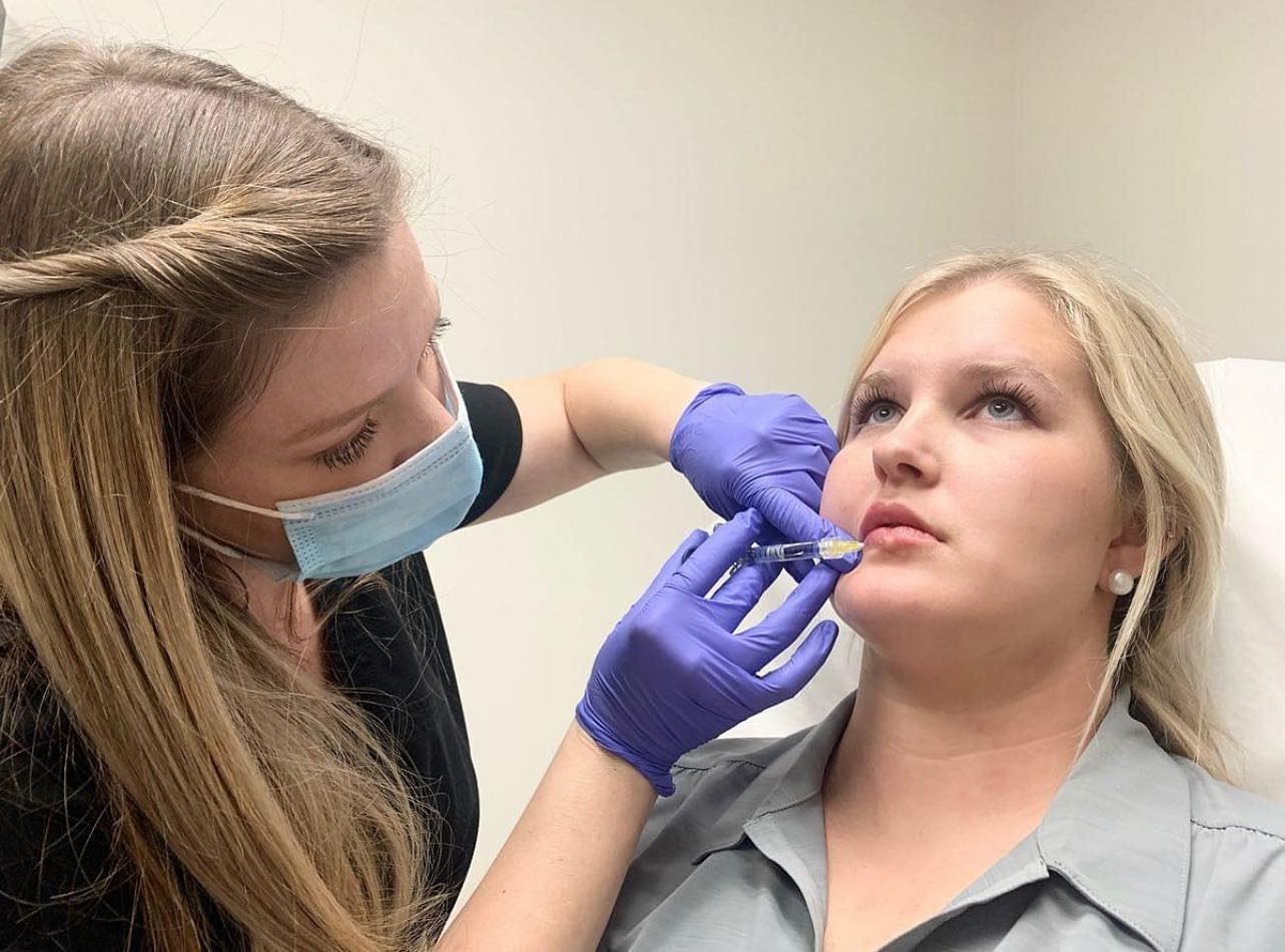 Lip Filler Brentwood TN | Subtle, Natural Lip Enhancements